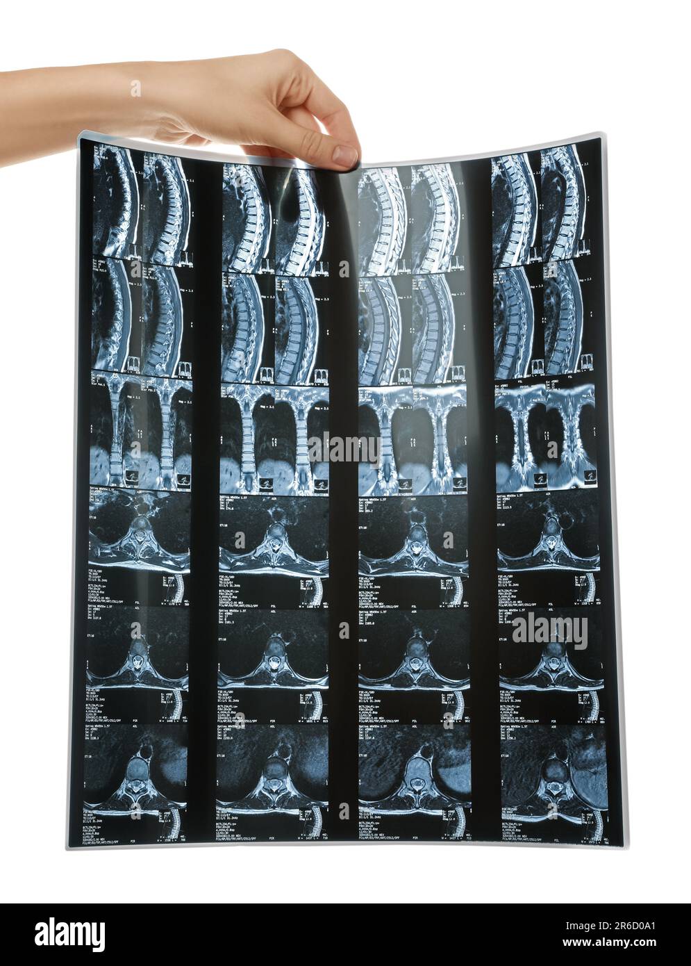 Irm de la colonne cervicale Banque d'images détourées - Alamy