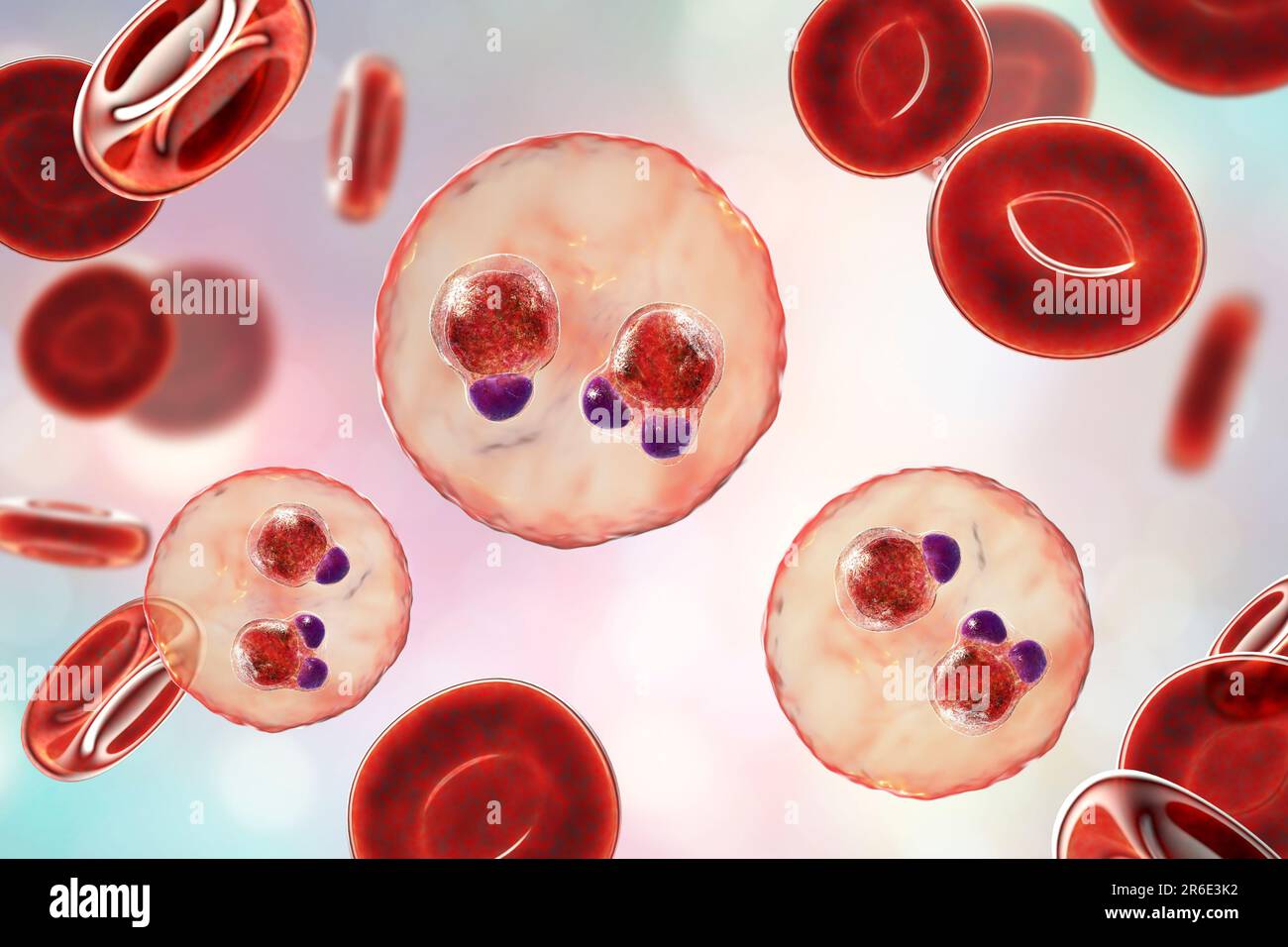 Protozoaire Plasmodium falciparum à l'intérieur des globules rouges ...