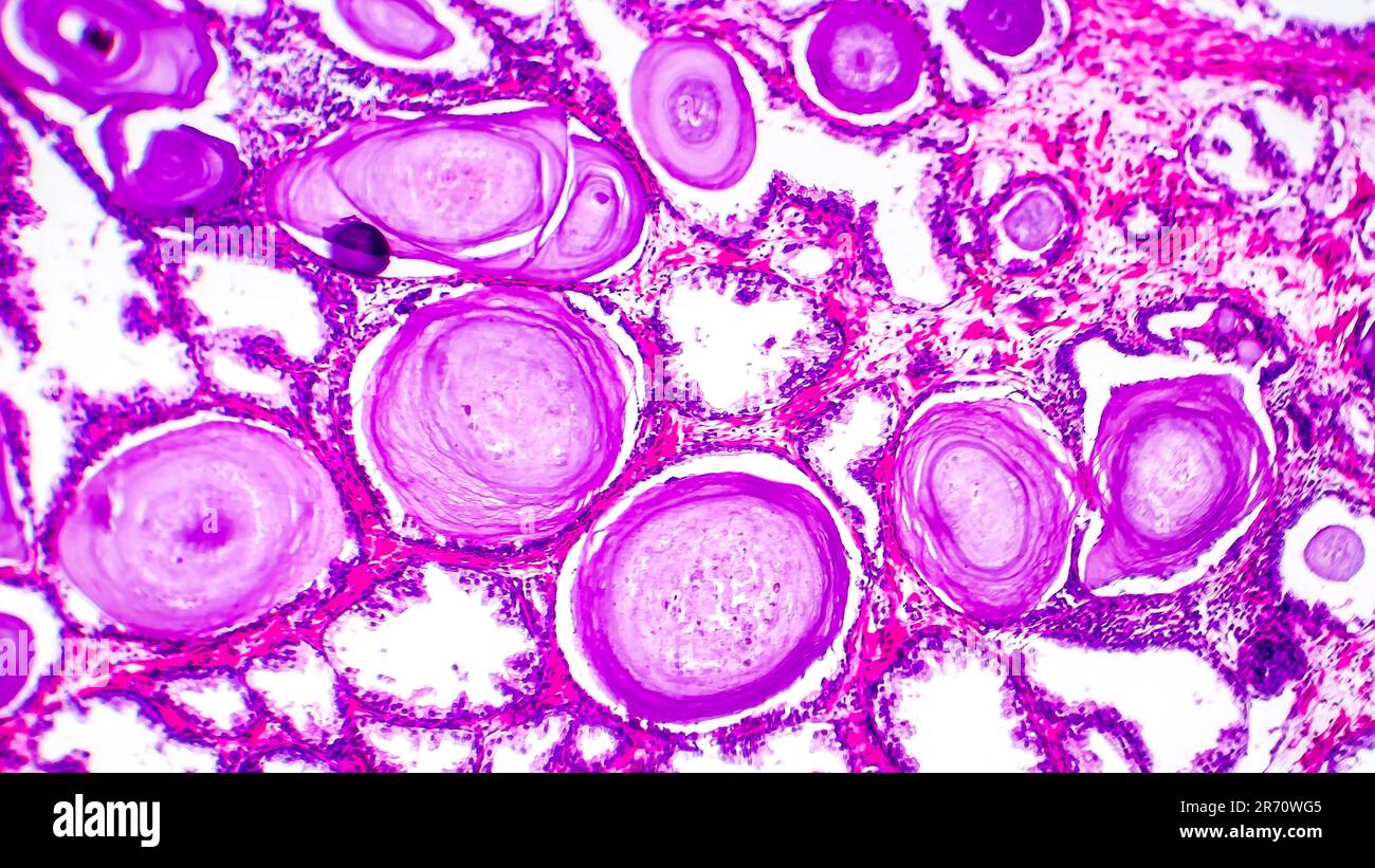 Glándula prostática histología Banque de photographies et d’images à ...