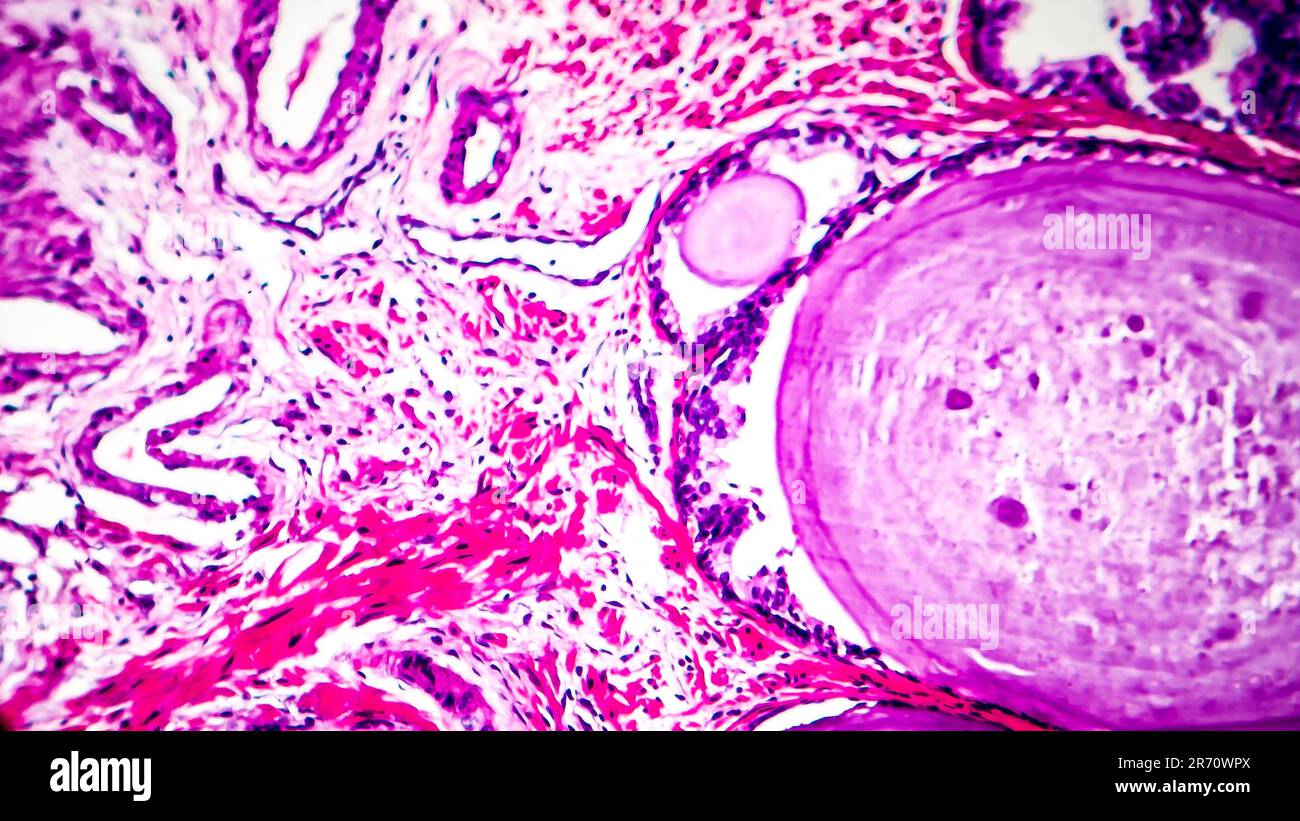 Glándula prostática histología Banque de photographies et d’images à ...