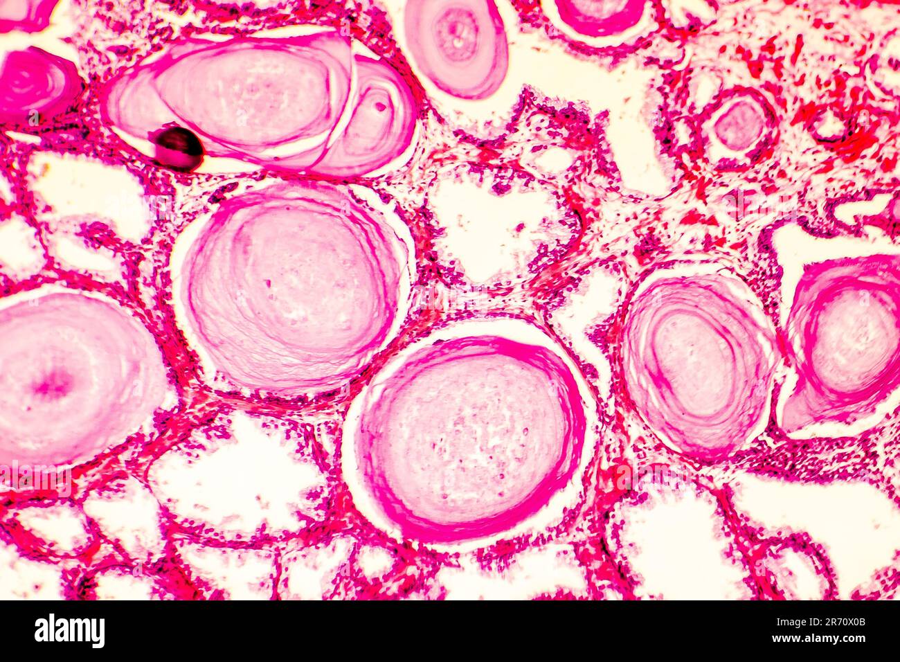 Glándula prostática histología Banque de photographies et d’images à ...