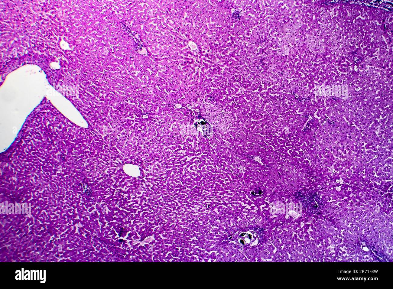 Schistosomiase hépatique, micrographe léger, photo sous microscope ...