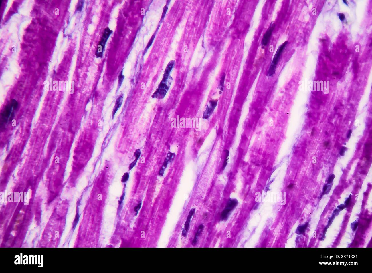Myocarde du muscle cardiaque Banque de photographies et d’images à ...