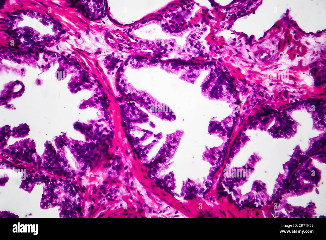 Glándula prostática histología Banque de photographies et d’images à ...