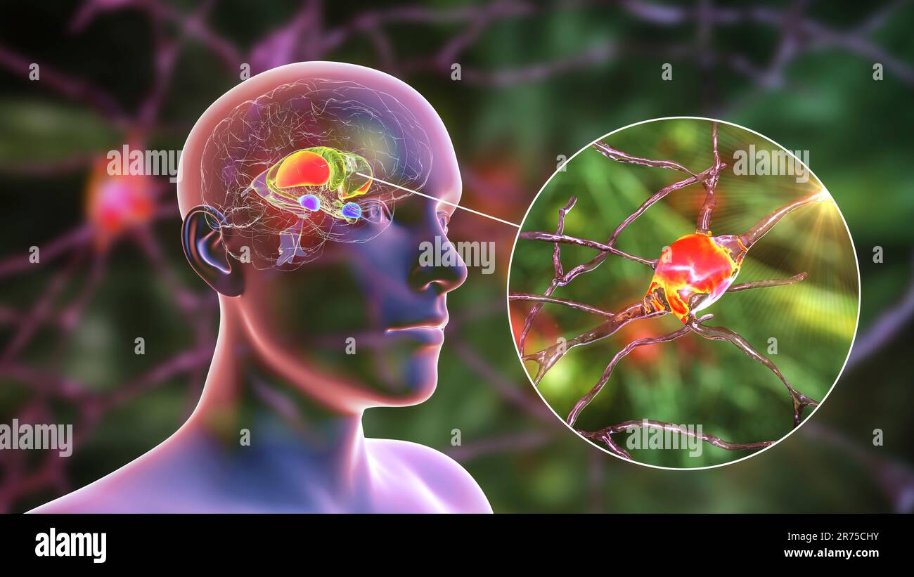 Striatum dorsal mis en évidence dans le cerveau humain et vue ...