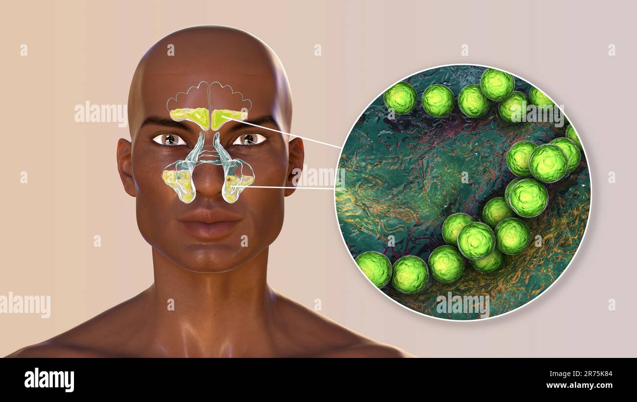 Anatomie du nez et des sinus Banque de photographies et d’images à ...