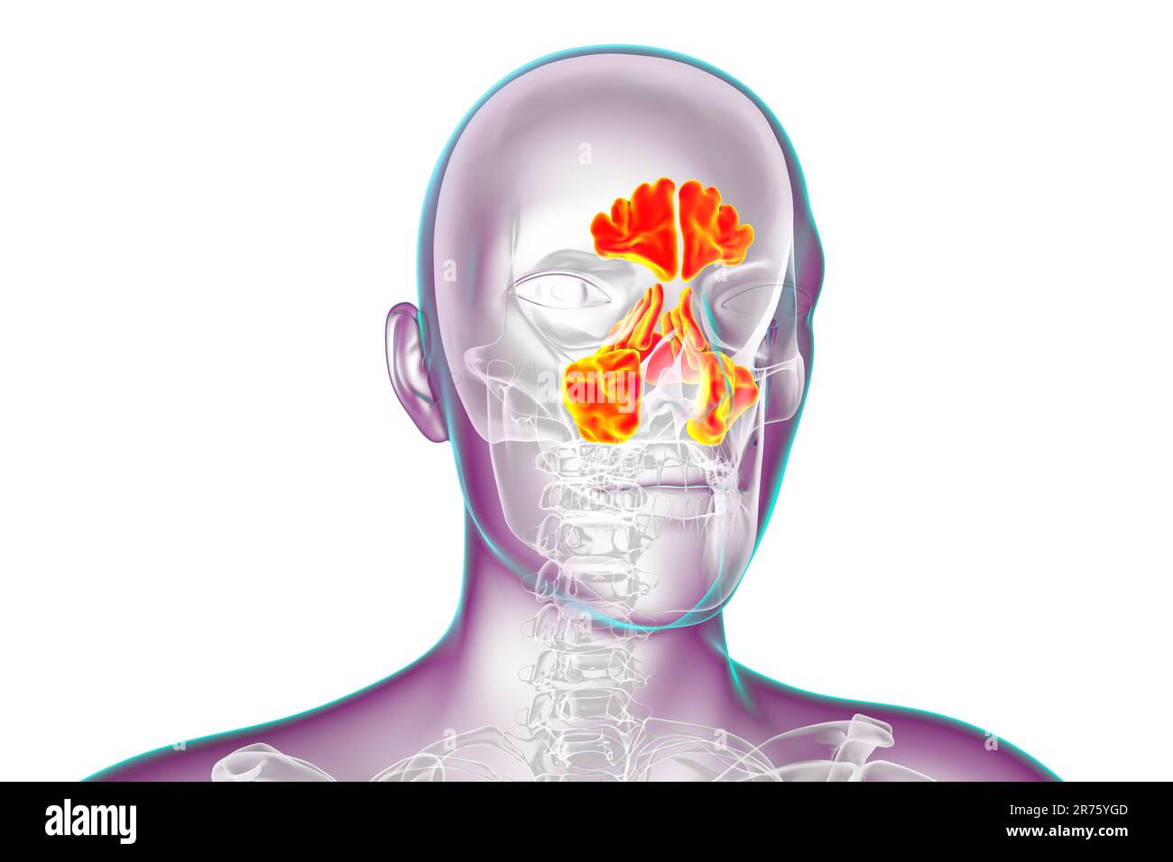 Sinus paranasaux humains, illustration informatique. Les sinus sont des ...