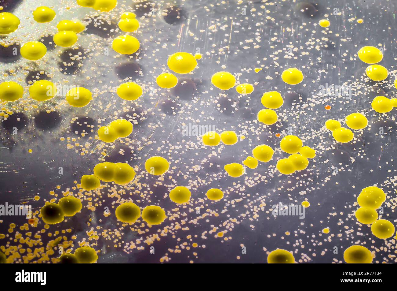 Bactéries cultivées à partir d'un frottis cutané, colonies de ...