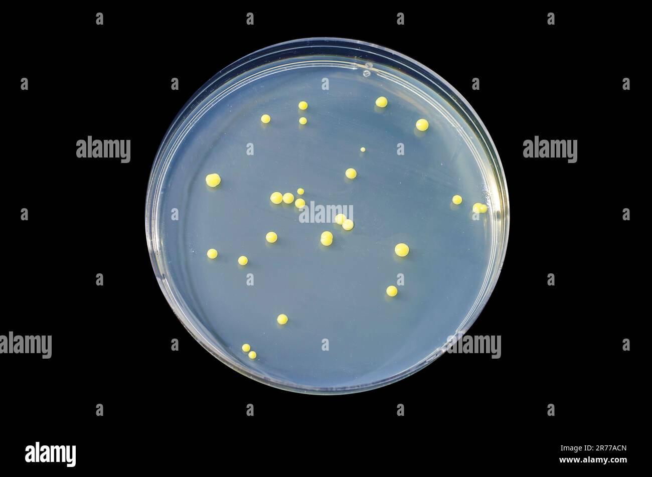 Colonies de bactéries Micrococcus luteus sur boîte de Pétri avec gélose ...