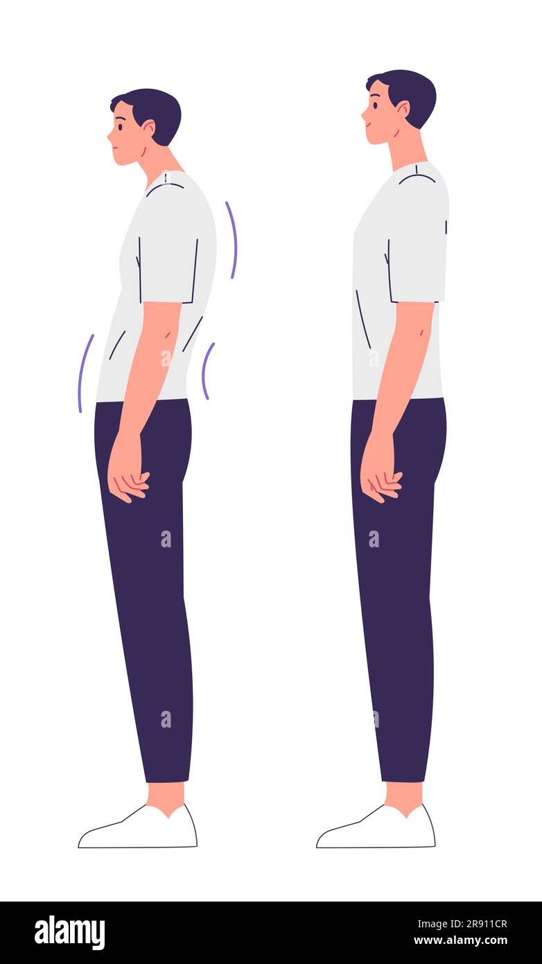Homme avec une posture altérée et une posture correcte. Courbure de la ...