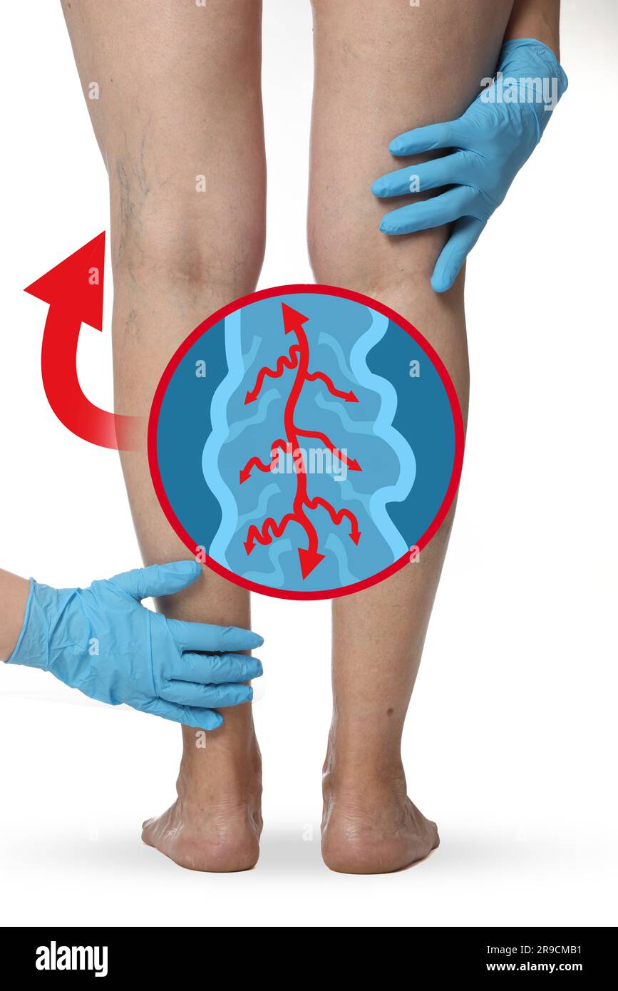 Longitudinal veins Banque de photographies et d’images à haute résolution - Alamy