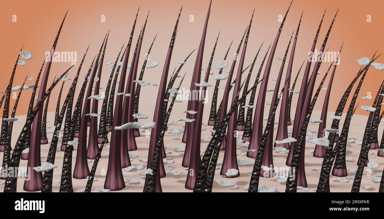 Follicules de cheveux et pellicules sous microscope - 3D illustration ...