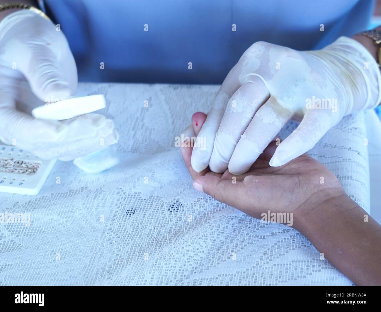 HCT , plaque de centrifugeuse d'hématocrite avec tube capillaire ...