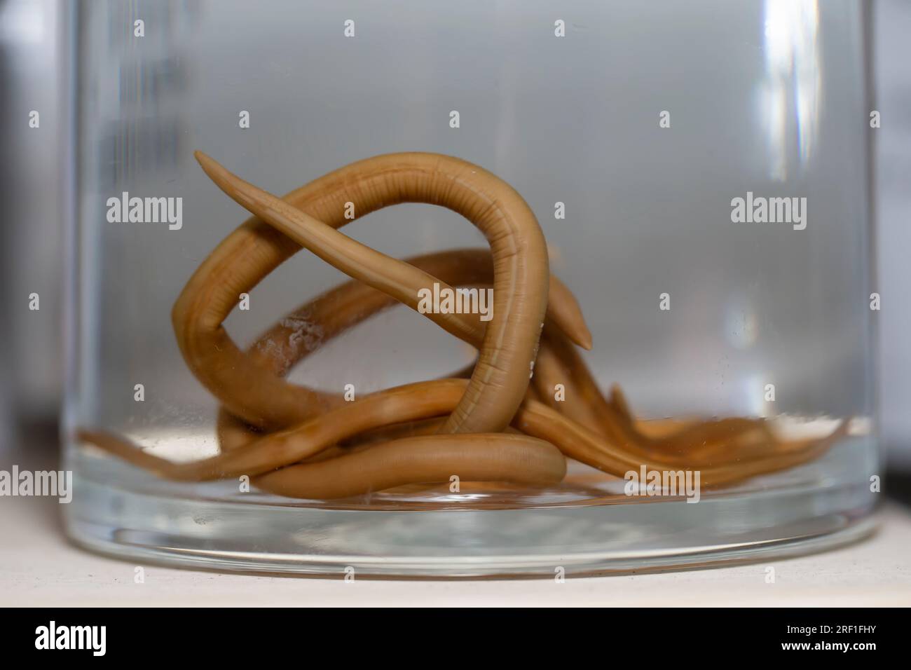 L'ascaridiose est une maladie causée par le ver rond parasite Ascaris lumbricoides qui se forme ...