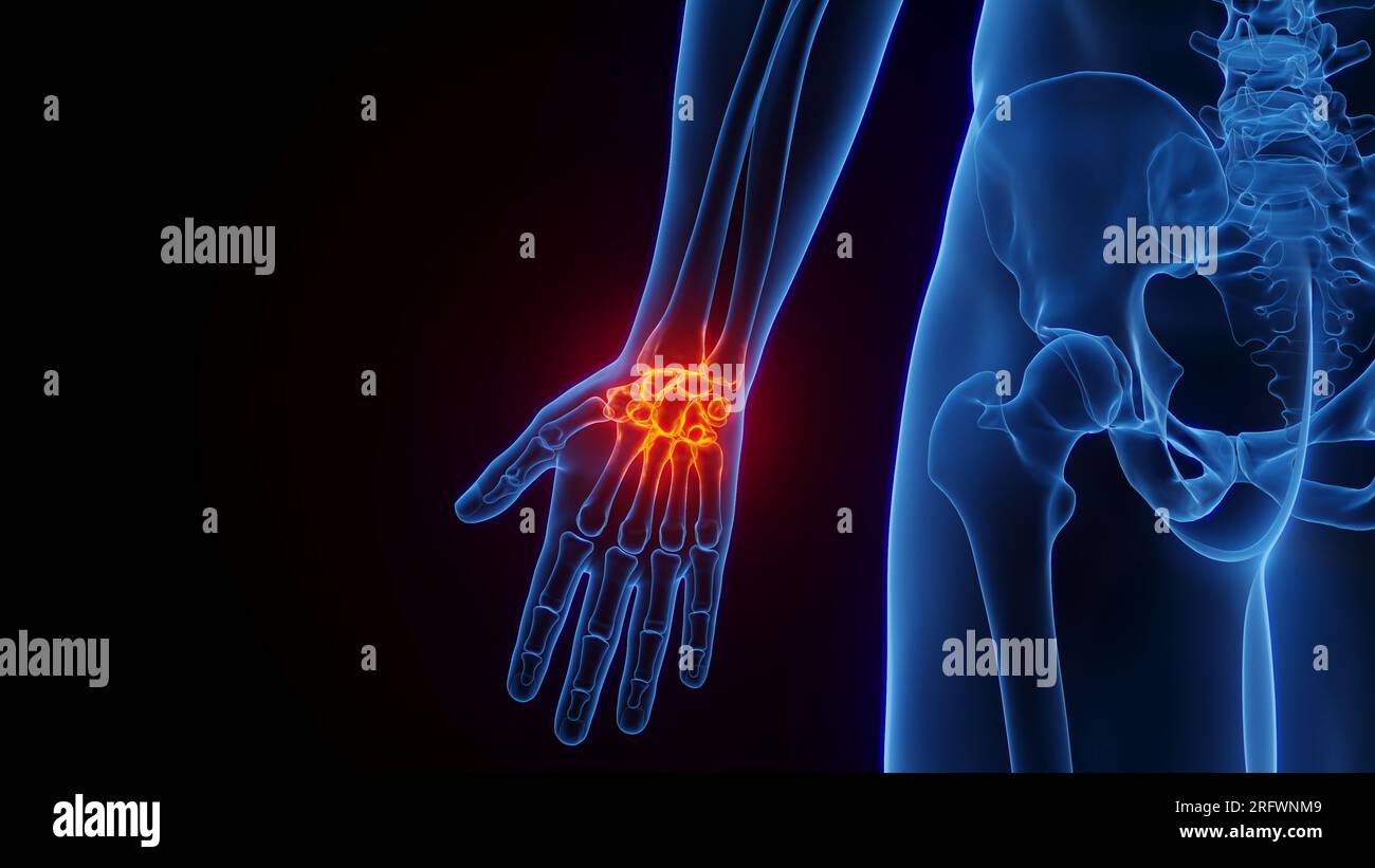 Anatomie du carpe du poignet Banque de photographies et d’images à ...
