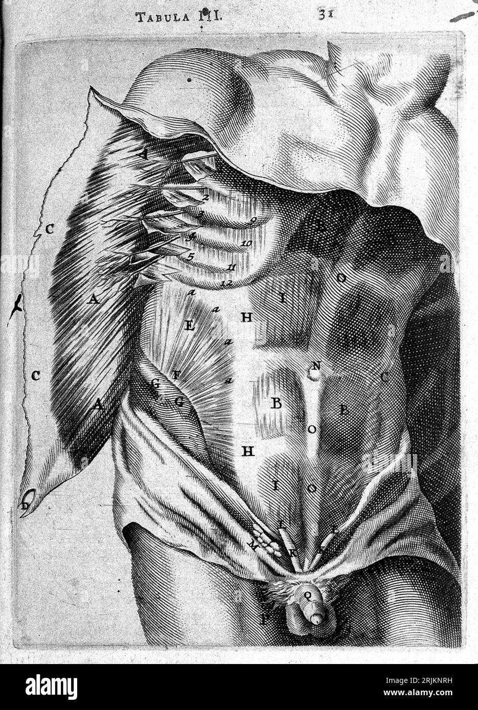 Transverse abdomen Banque de photographies et d’images à haute ...