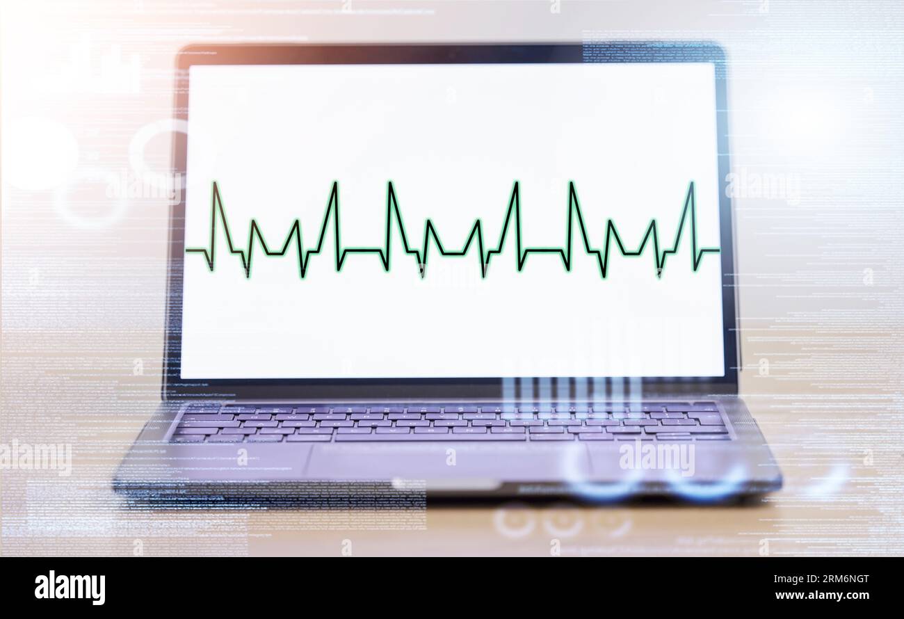 Ordinateur portable, logiciel et écran, code et ECG, technologie de l'information avec ...