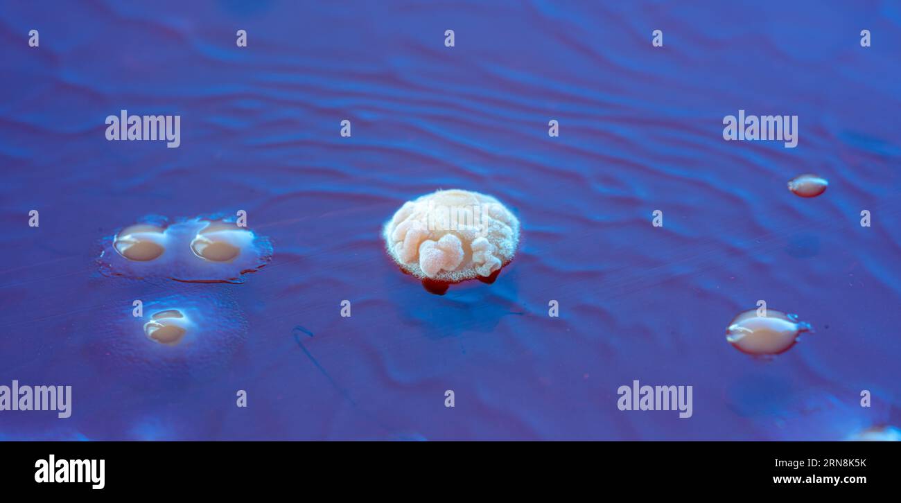 Colonies de micro-organismes et de champignons à la surface d'un milieu ...