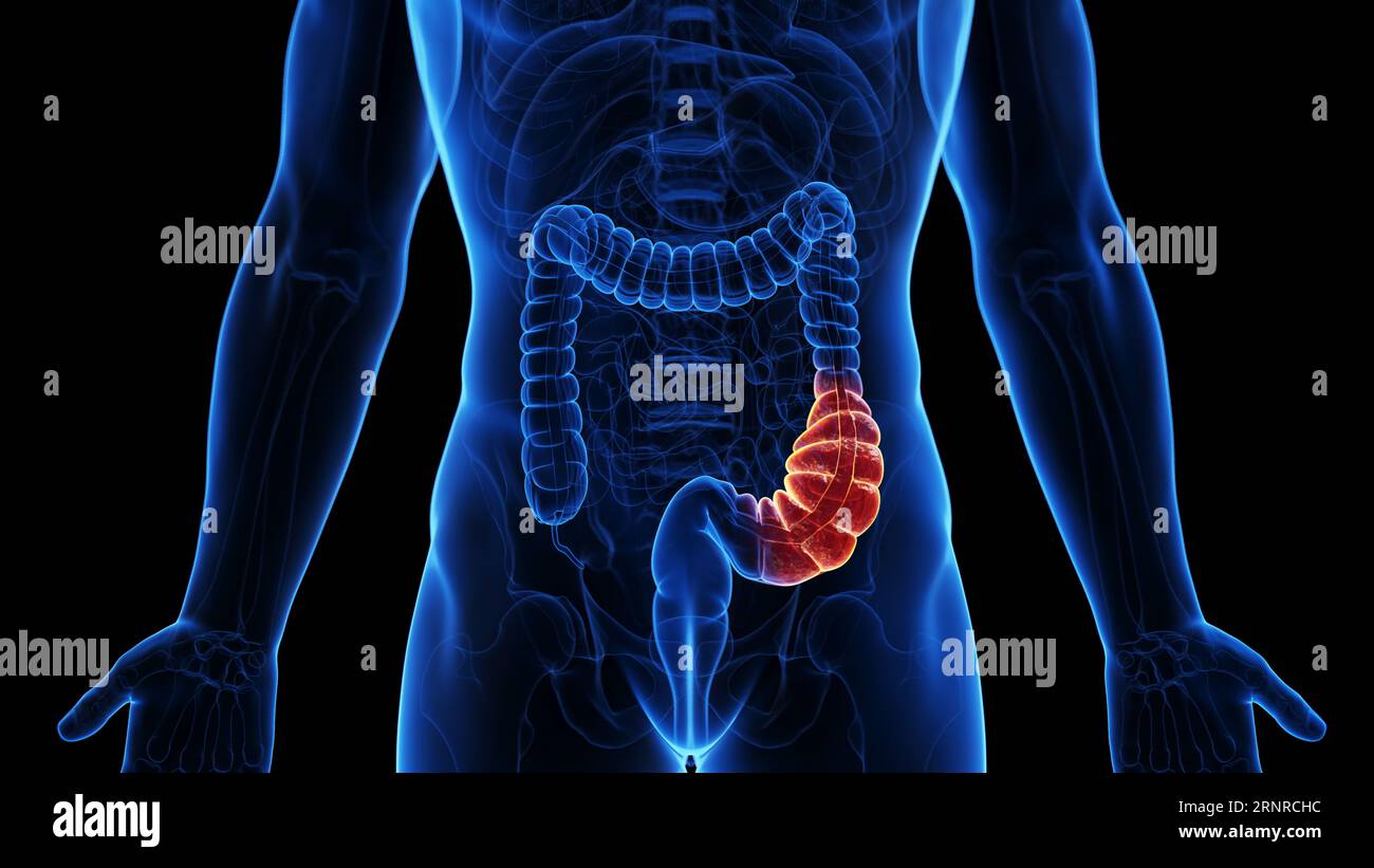 Constipated colon Banque de photographies et d’images à haute ...