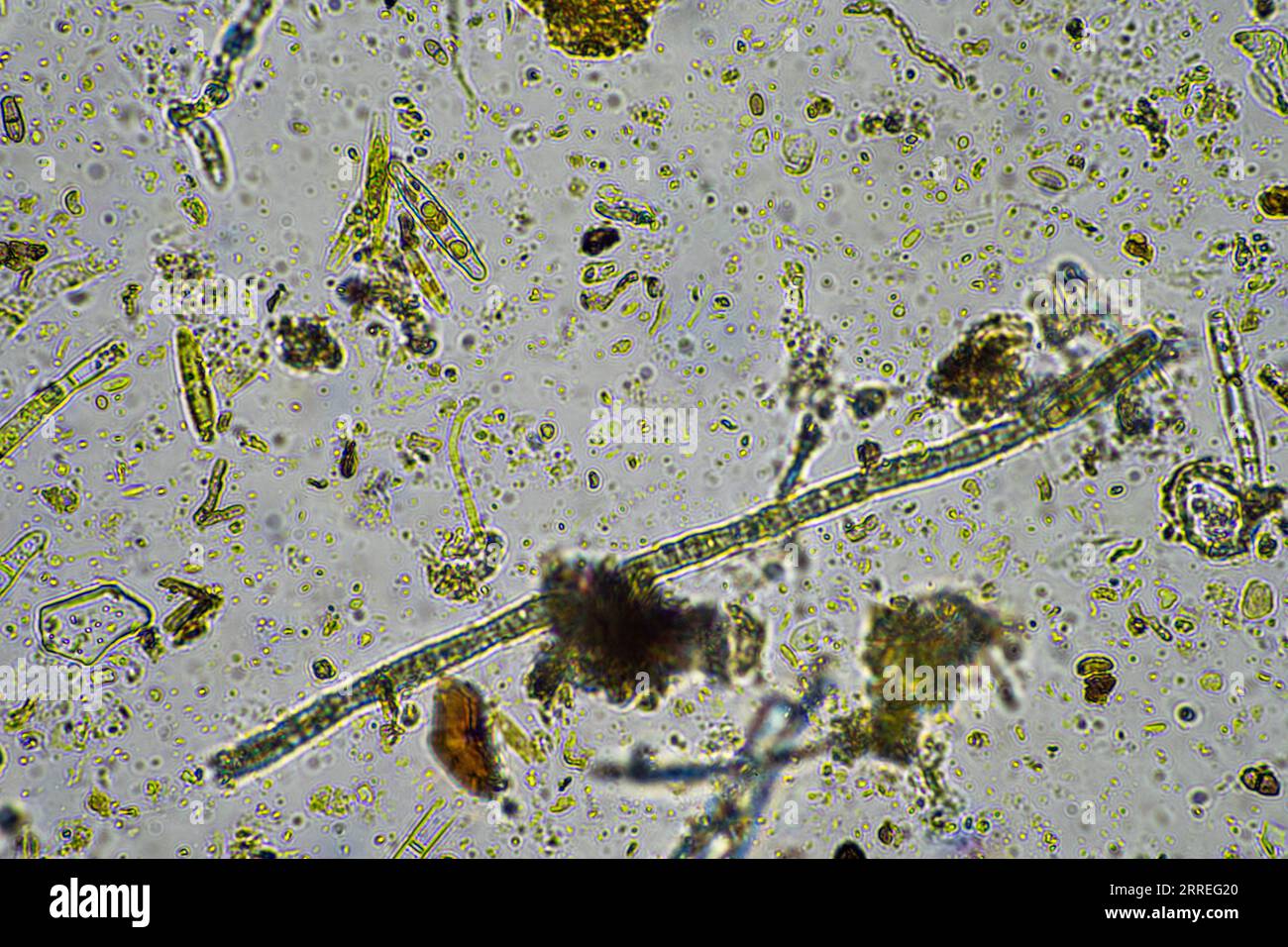 Microbiologie des sols agricoles Banque de photographies et d’images à ...