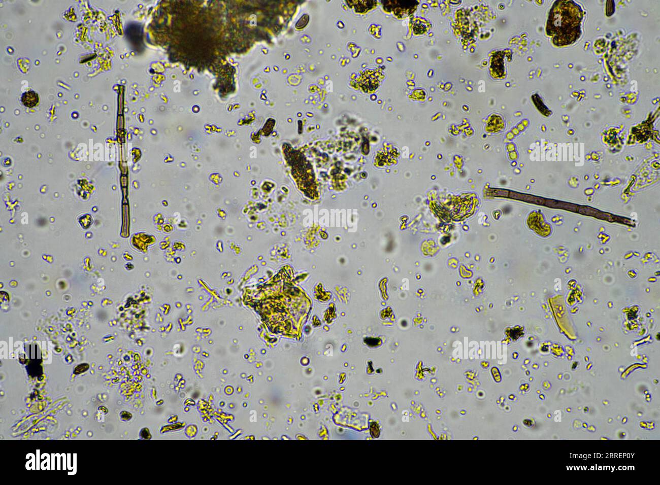Microbiologie des sols agricoles Banque de photographies et d’images à ...
