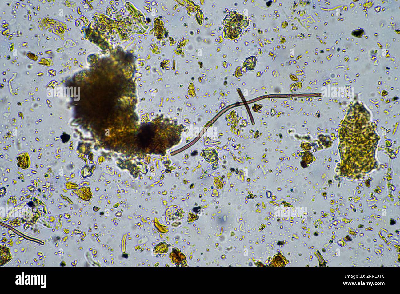 Microbiologie des sols agricoles Banque de photographies et d’images à ...