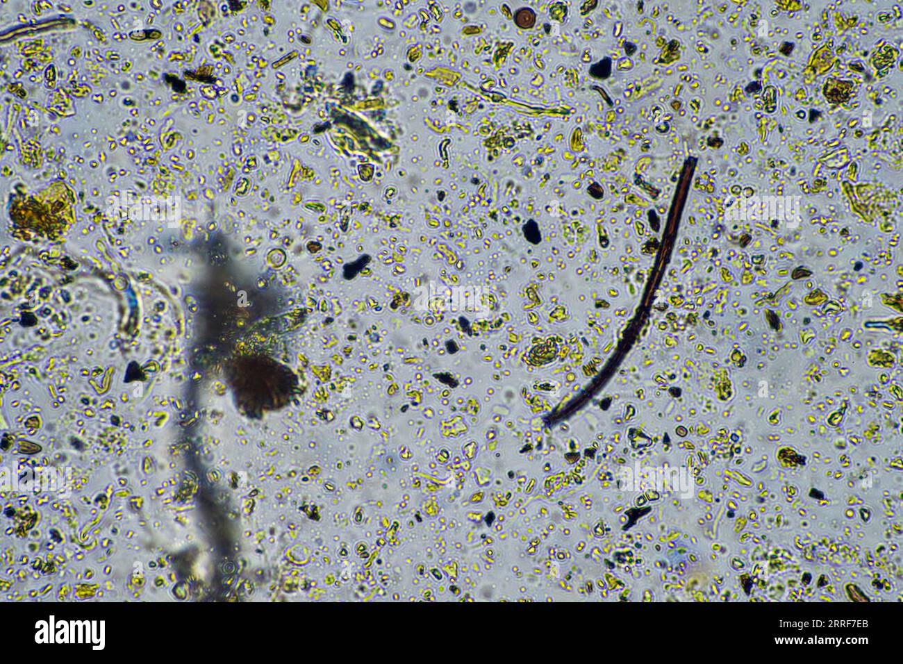 Microbiologie des sols agricoles Banque de photographies et d’images à ...
