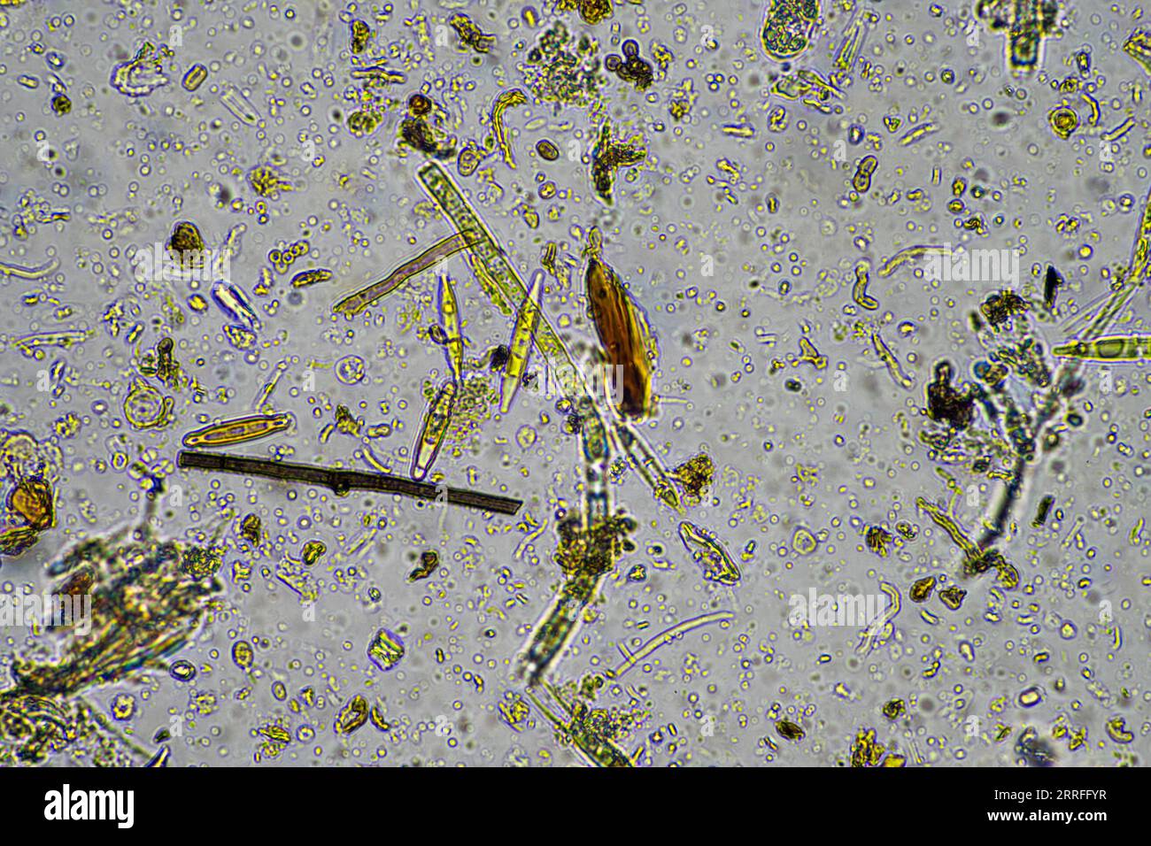 Cyanobacteria microscope Banque de photographies et d’images à haute ...