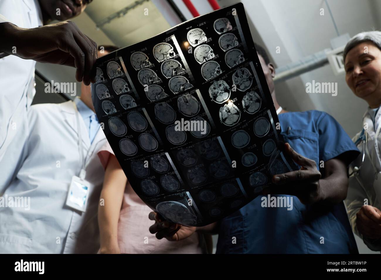 Mise au point sur l'image radiologique du cerveau d'un patient au cours de la discussion d'un ...