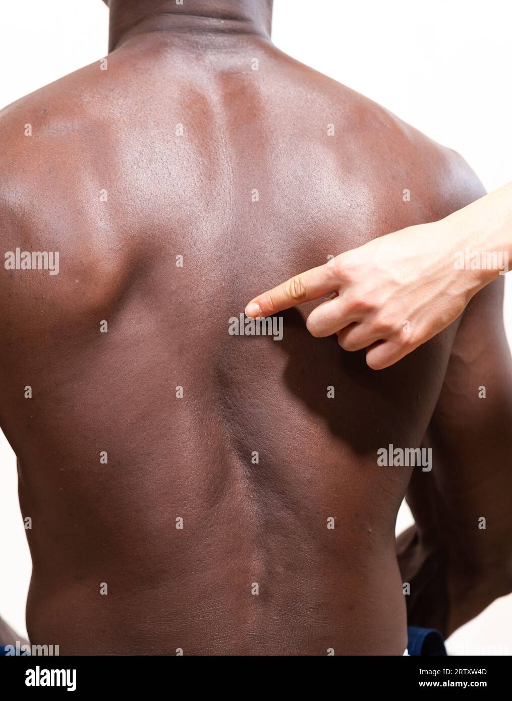 Scoliosis doctor Banque de photographies et d’images à haute résolution ...