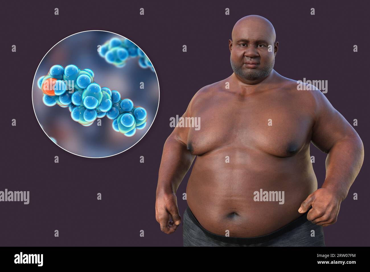 Surpoids homme profil Banque de photographies et d’images à haute ...