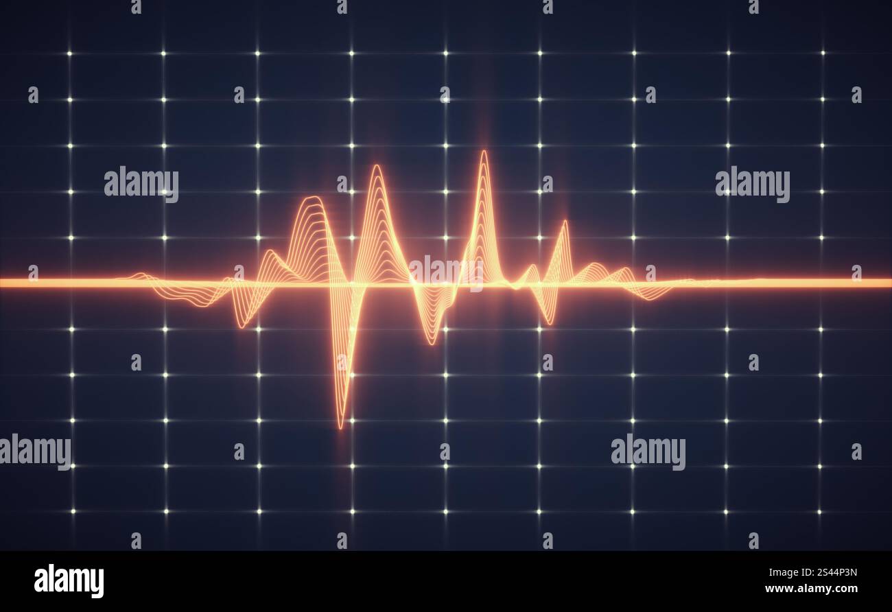 Diagrama de ekg Banque de photographies et d’images à haute résolution ...