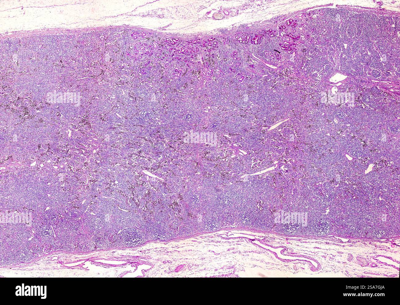 Ganglion lymphatique humain. Micrographie à la lumière montrant les ...