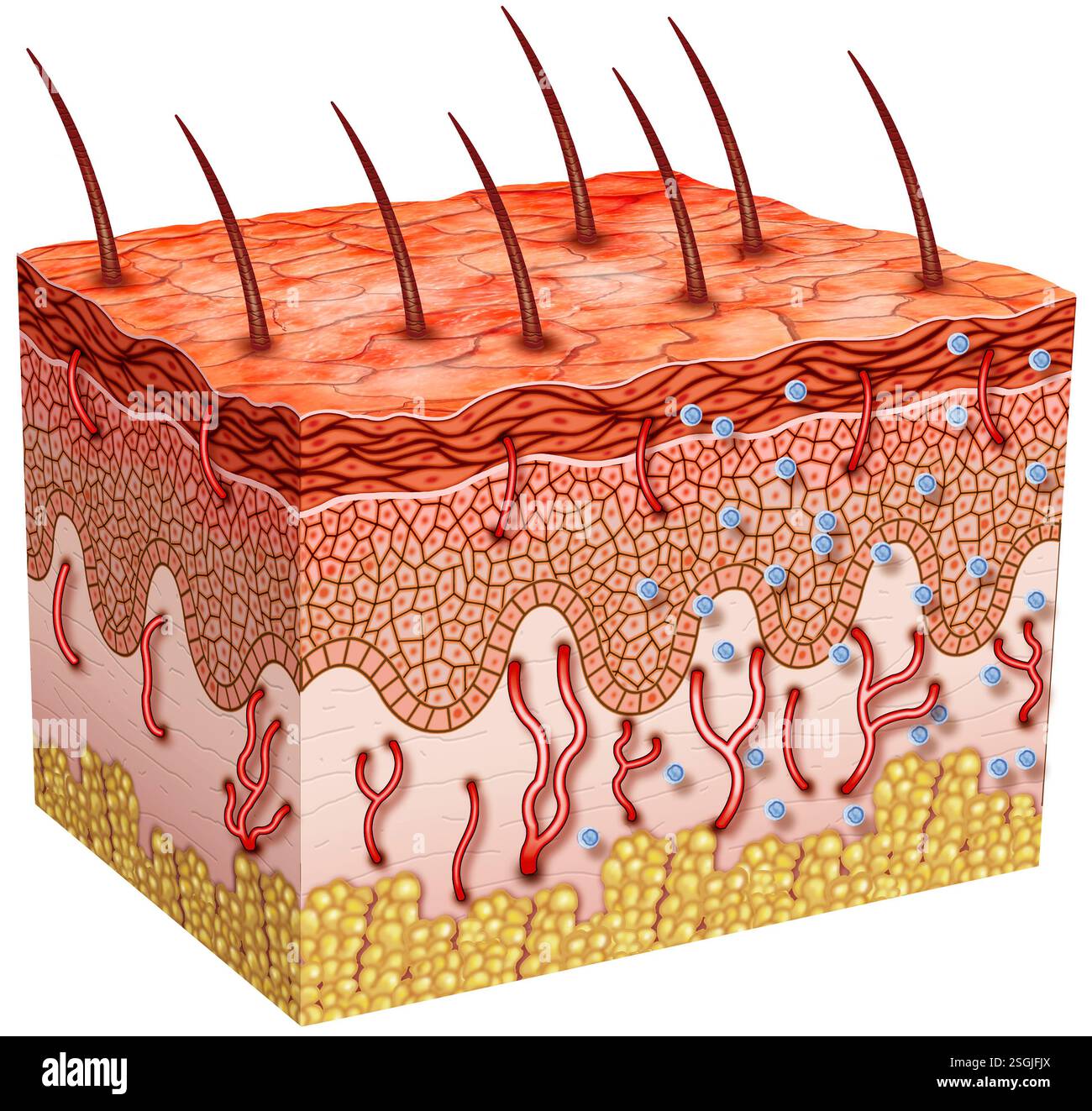 Dermatite séborrhéique du cuir chevelu Banque d'images détourées - Alamy