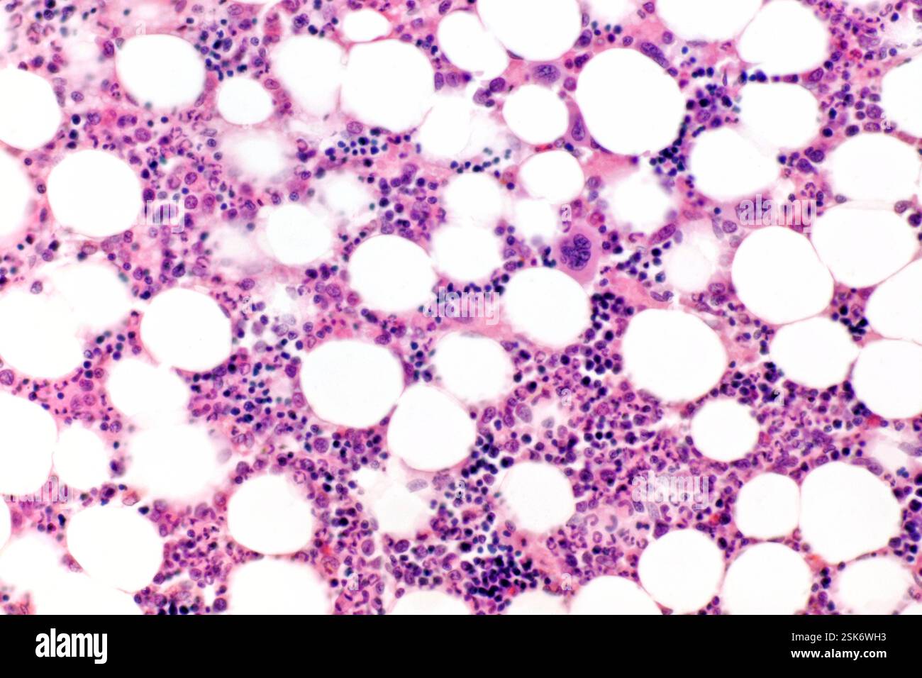 Micrographie légère de moelle osseuse rouge, montrant le tissu ...