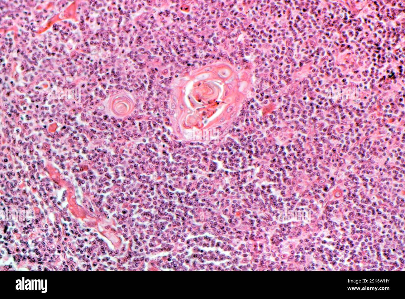 Micrographie à la lumière d'une coupe à travers une jeune glande thymus ...