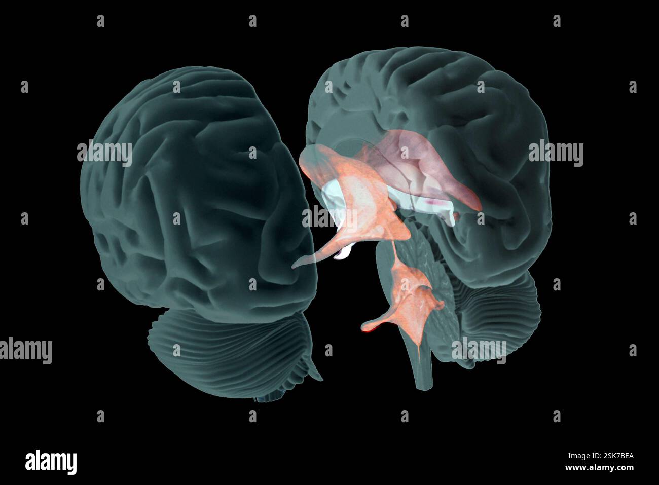Cerveau humain. Imagerie par résonance magnétique (IRM) 3D en couleur d ...