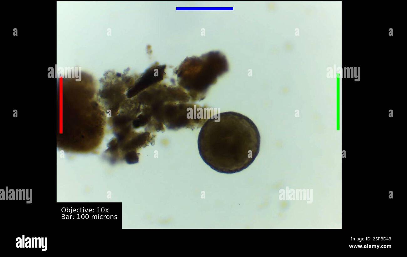 Arcella sp Banque de photographies et d’images à haute résolution - Alamy