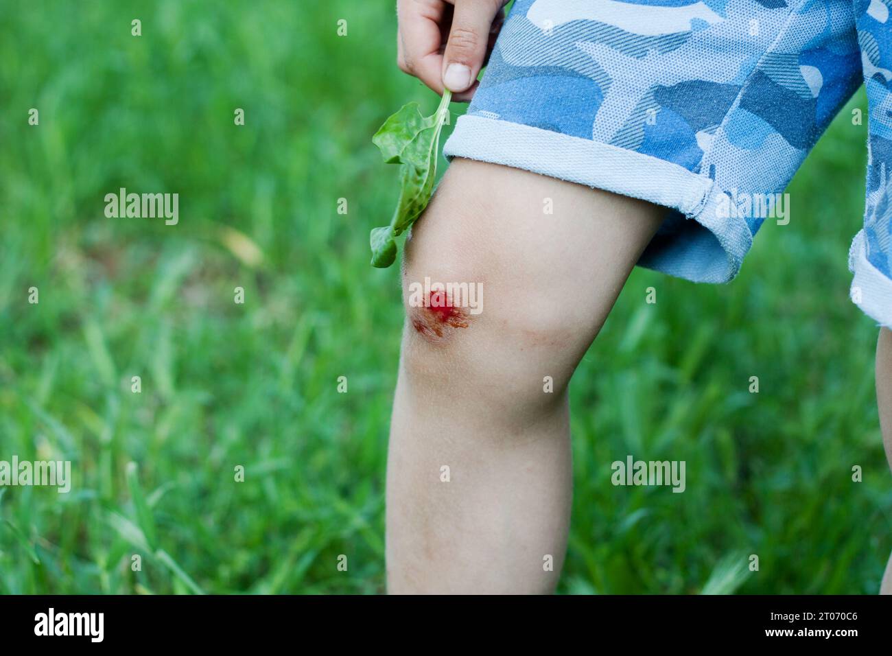 Gros plan d'une plaie hémorragique fraîche sur le genou de l'enfant ...