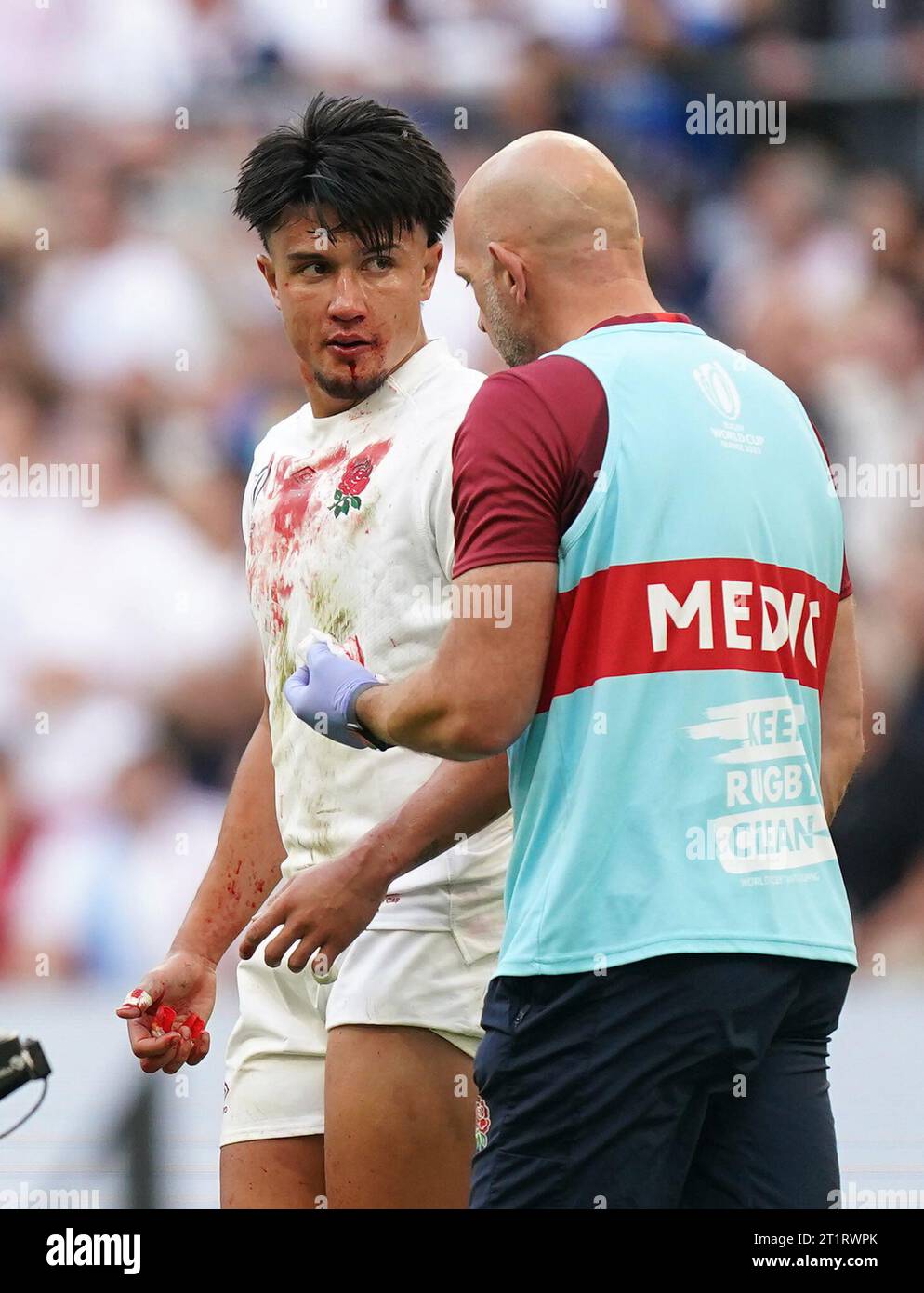 L'Anglais Marcus Smith quitte le match avec une blessure lors du match ...