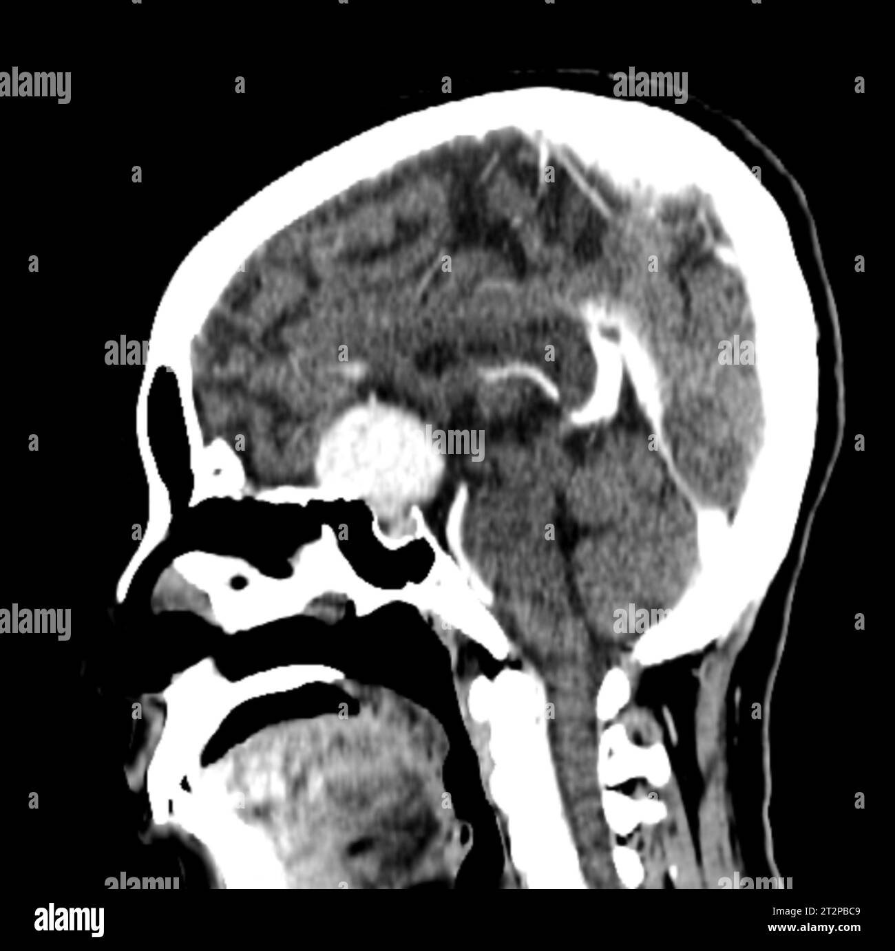 Sagittal ct Banque de photographies et d’images à haute résolution - Alamy