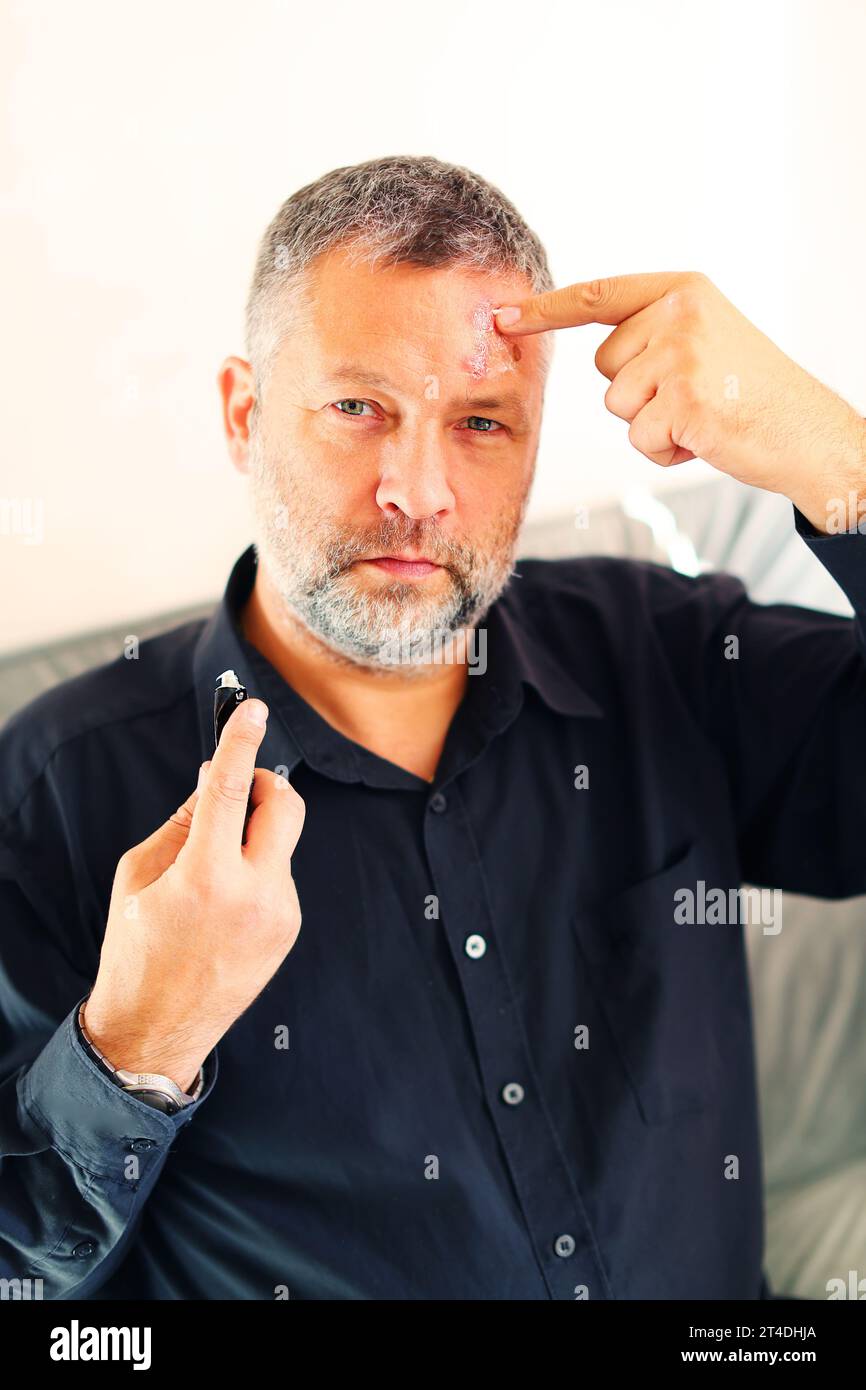 Urticaire visage Banque de photographies et d’images à haute résolution ...