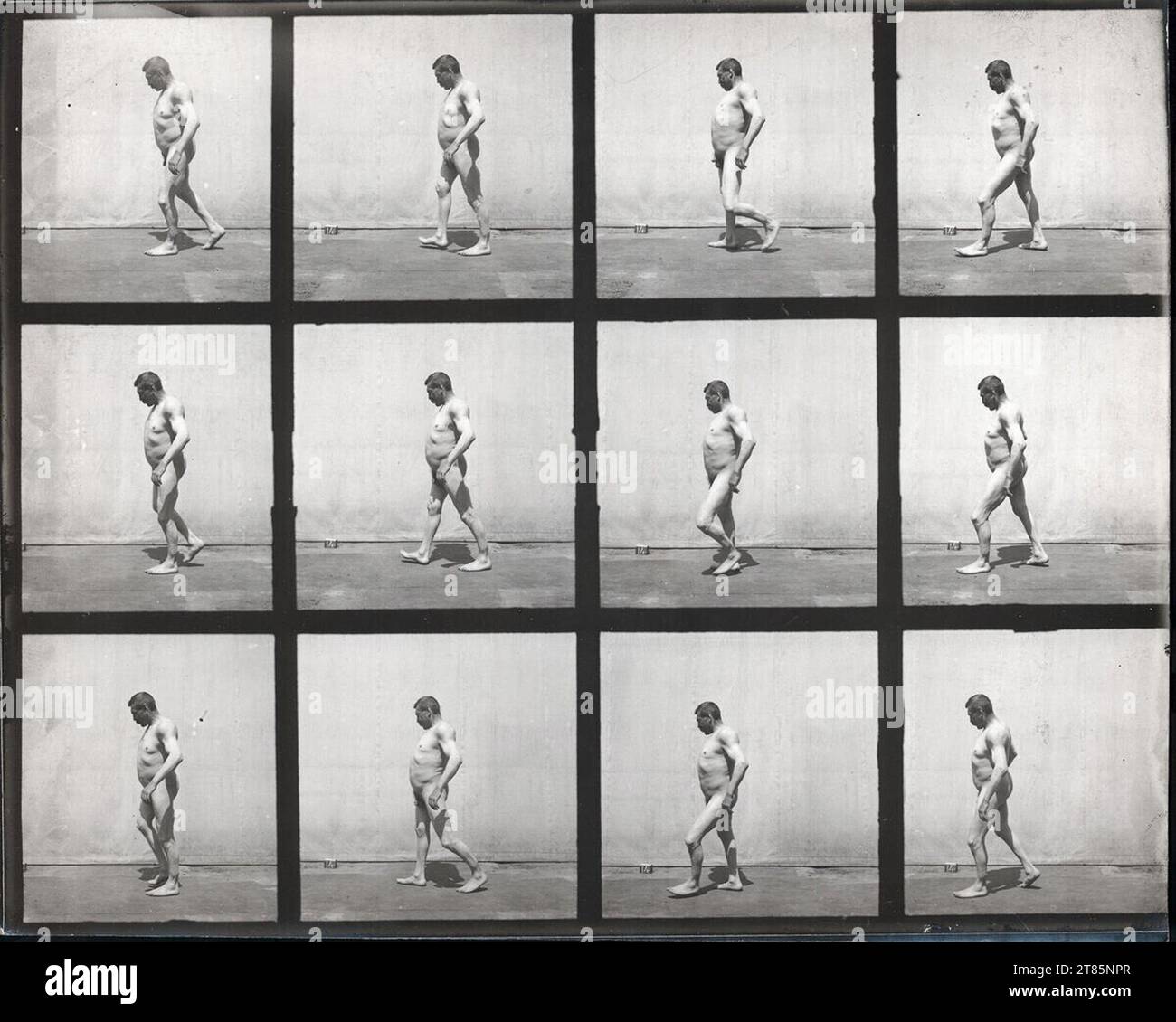 Arthopathie Banque de photographies et d’images à haute résolution - Alamy