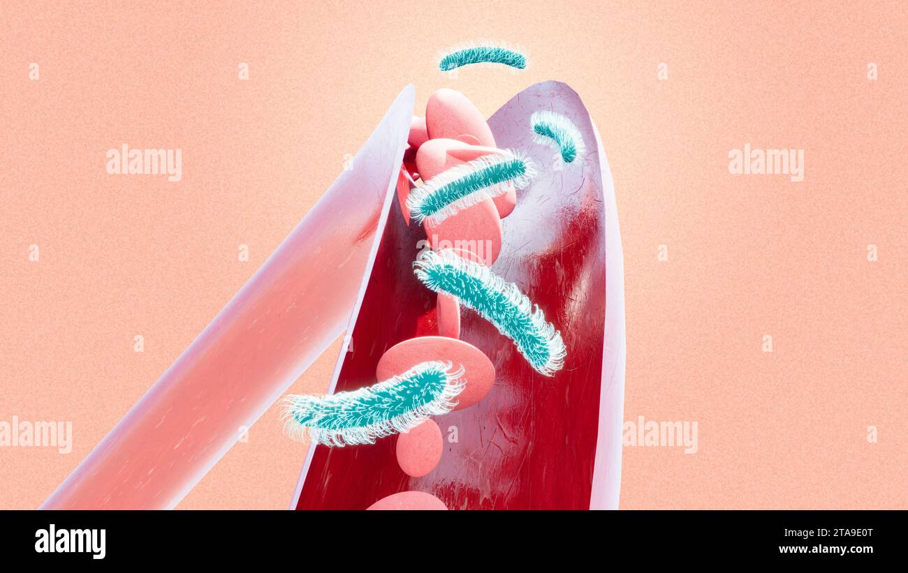 Flux sanguin, veines et globules rouges et septicémie. Il s'agit d'une ...