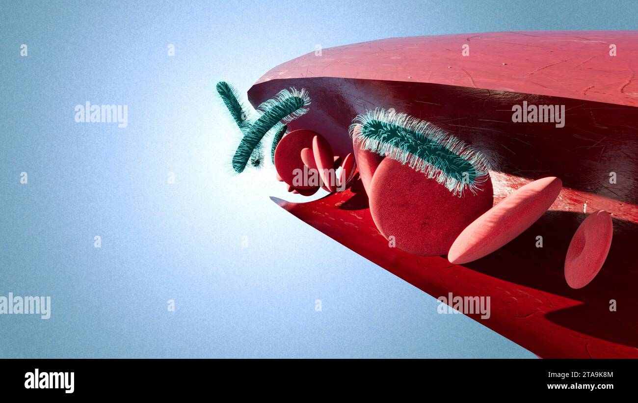 Flux sanguin, veines et globules rouges et septicémie. Il s'agit d'une ...