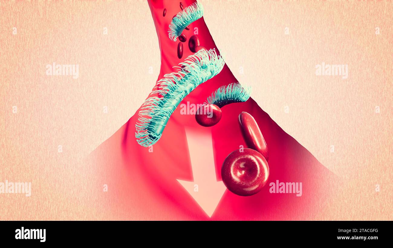 Flux sanguin, veines et globules rouges et septicémie. Il s'agit d'une ...