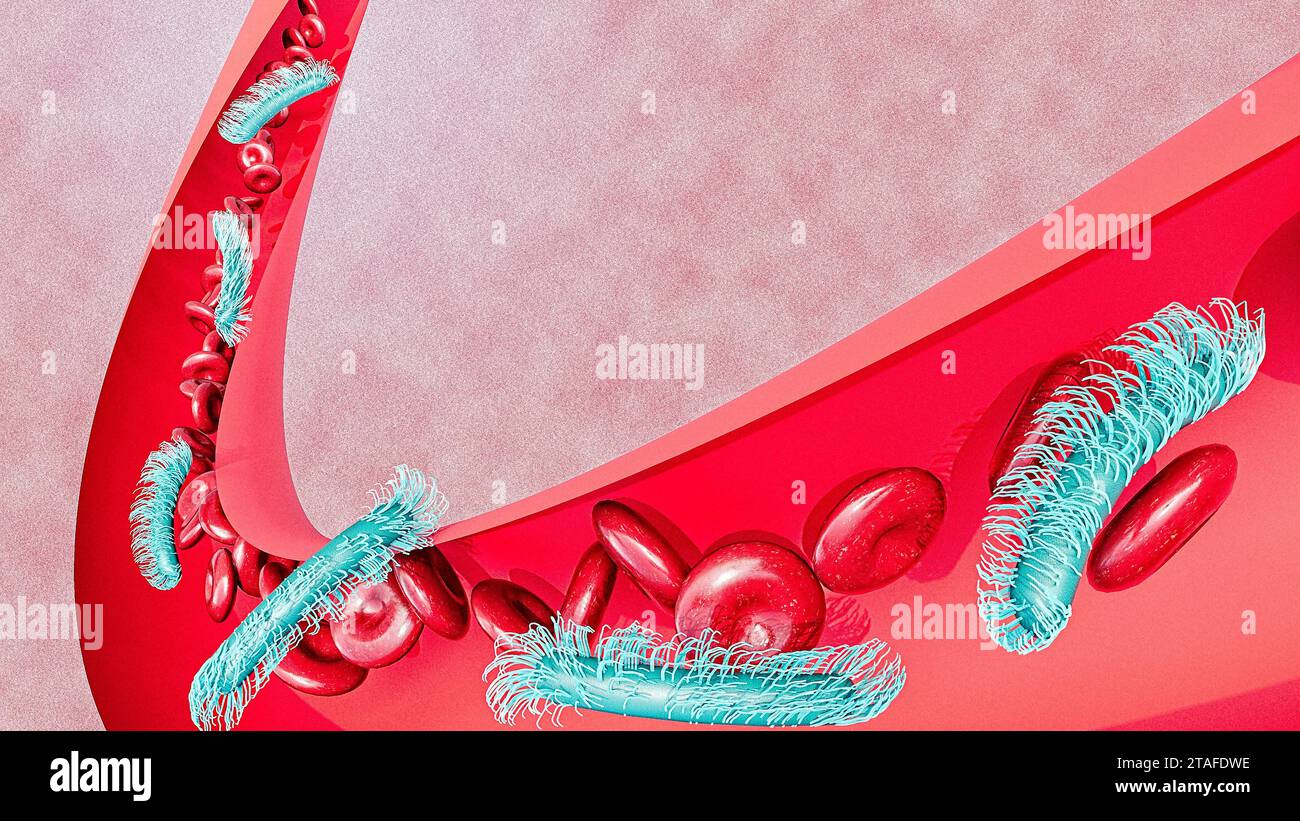 Flux sanguin, veines et globules rouges et septicémie. Il s'agit d'une ...