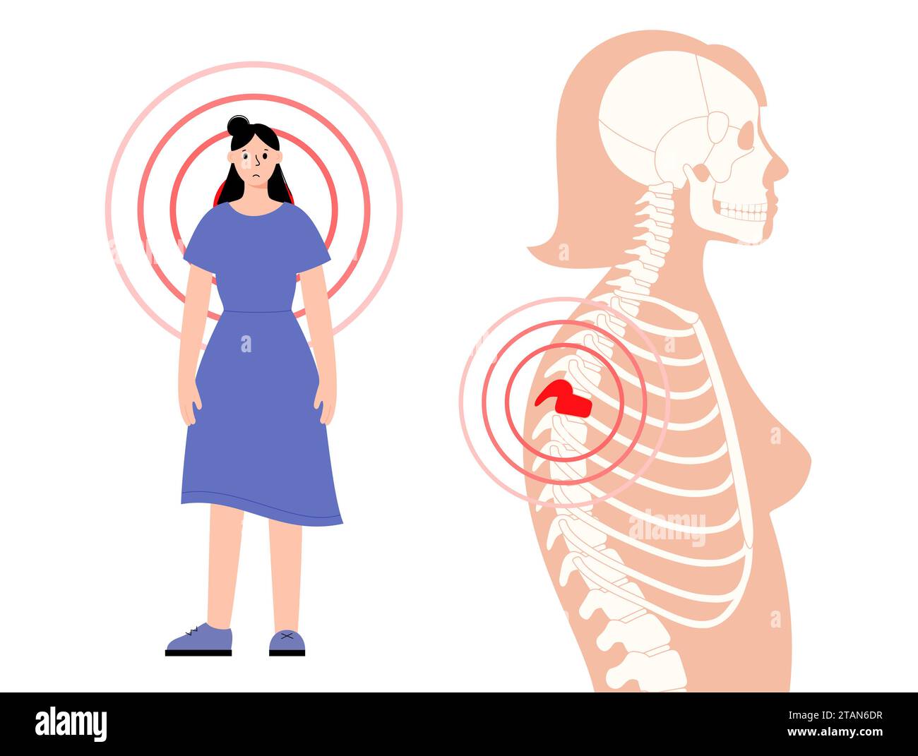 Femme l'examen médical scoliose Banque d'images détourées - Alamy