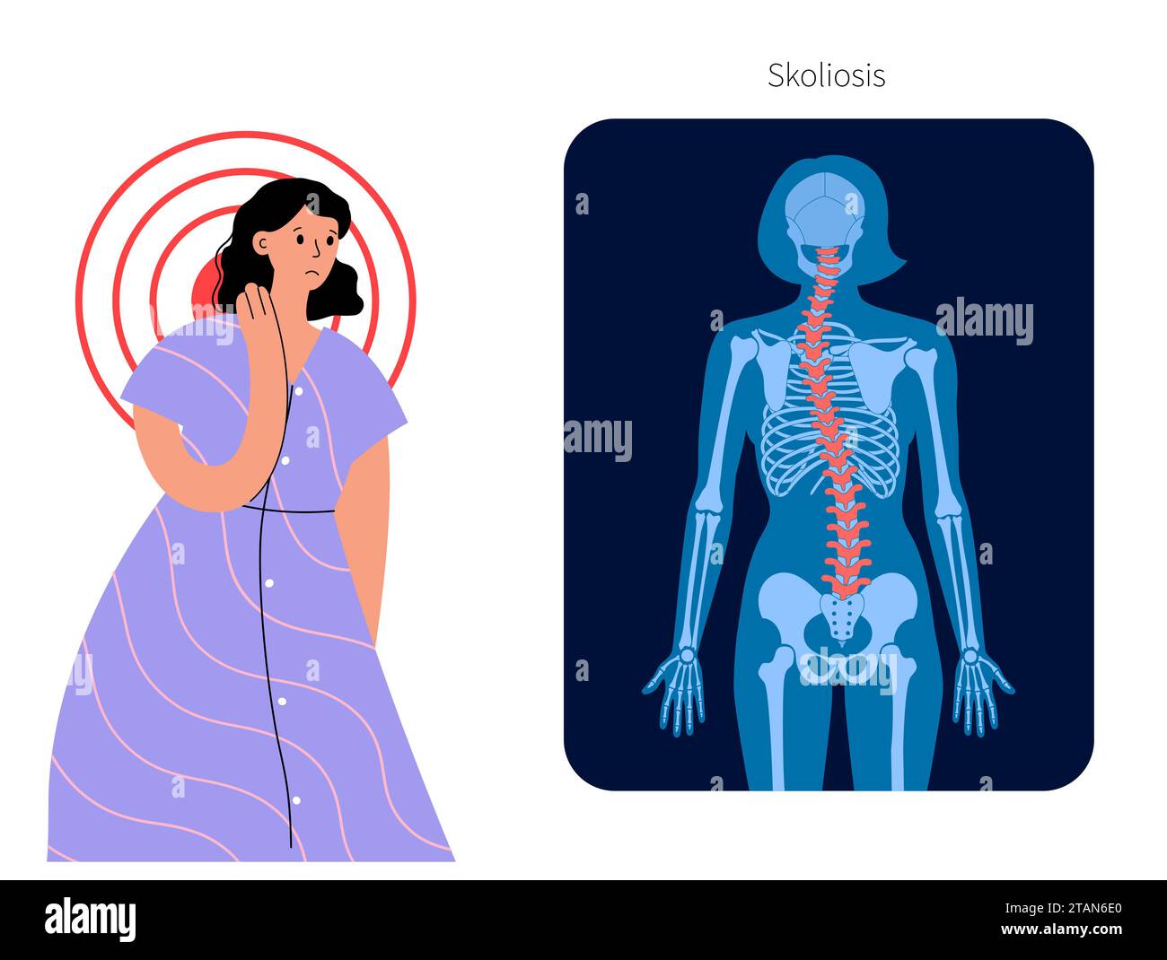 Femme l'examen médical scoliose Banque d'images détourées - Alamy