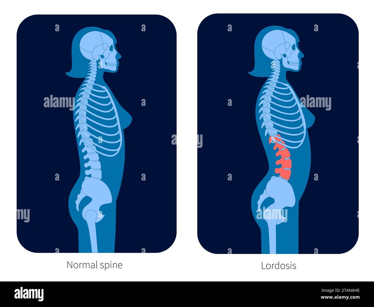 Femme l'examen médical scoliose Banque d'images détourées - Alamy